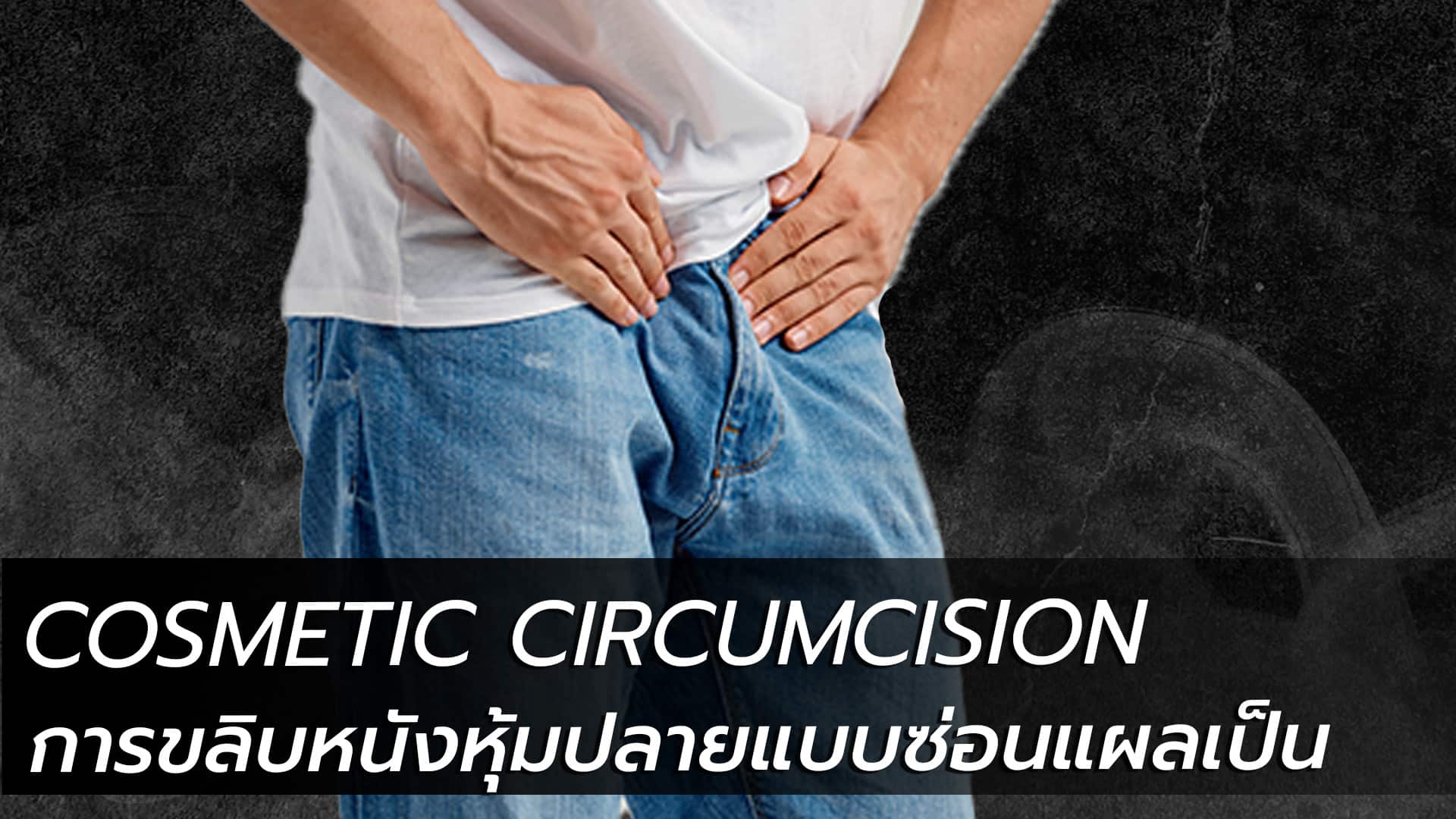ขลิบหนังหุ้มปลายแบบซ่อนแผลเป็น - CLINICFORMEN