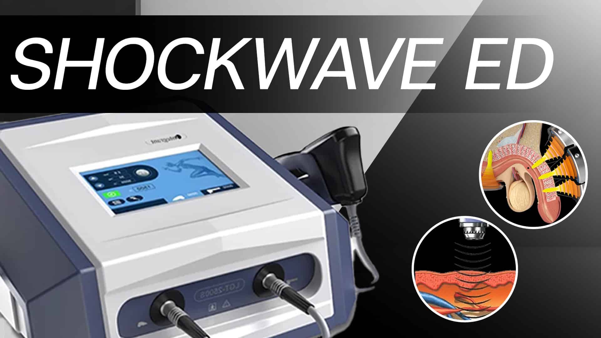 Shockwave ED ช็อกเวฟน้องชาย - CLINICFORMEN